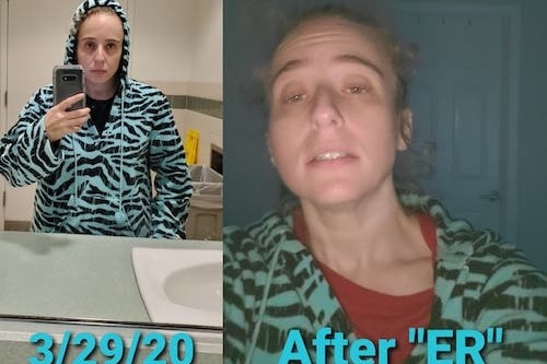 Fundraiser by Elana Simon : Elana's Need for Complex Treatment During ...