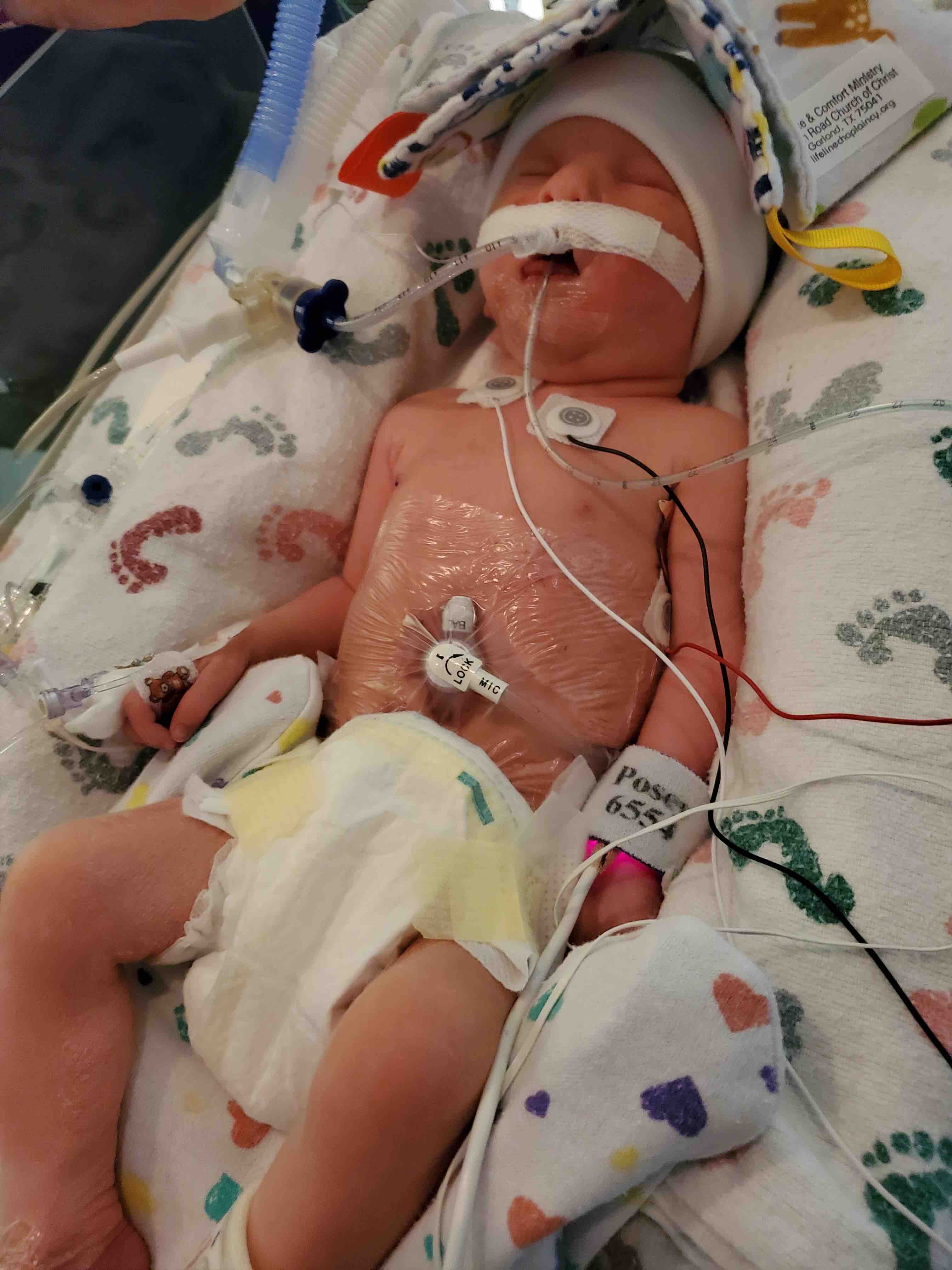 Fundraiser for Marilyn Marie McLemee by Melody Cano : Baby Kayson’s ...