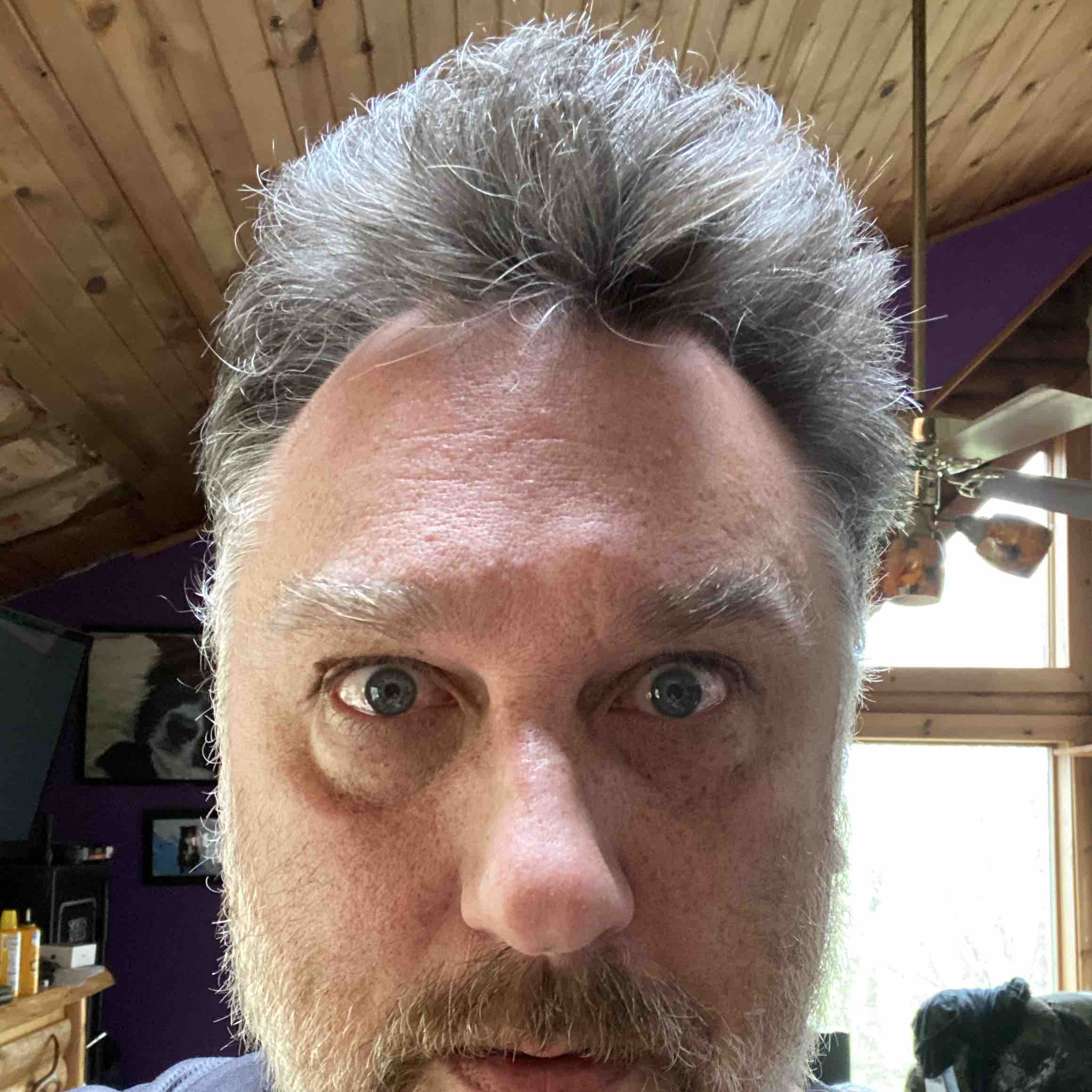 Fundraiser by Jay Gross : Shaving For Dalis!!