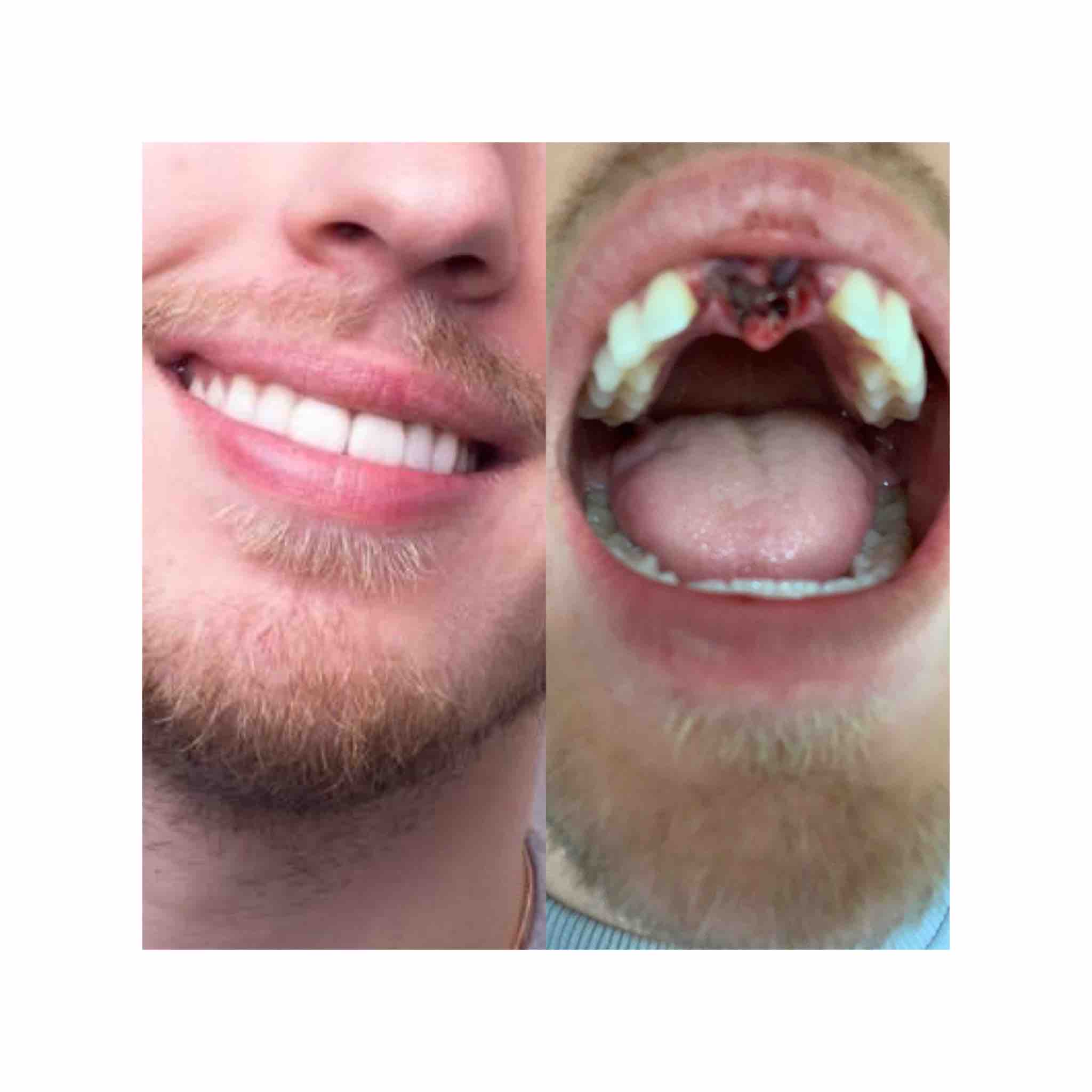 Fundraiser by Geraint Heaney : Help Geraint Get His Smile Back