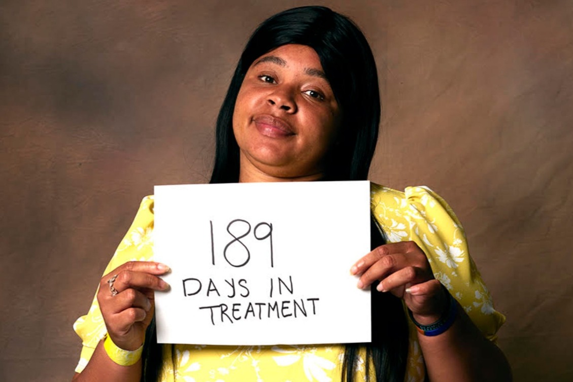 Soft White Underbelly -Amanda’s Rehab update | Lipstick Alley