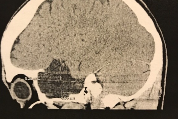 Fundraiser for Tina Yarbrough by Amanda Strong : Jake's Fight