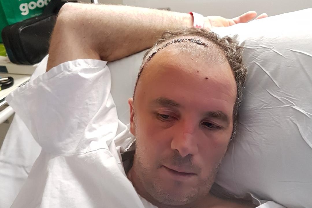 Fundraiser for Aaron Tempone by Sam Anthony Galluzzo : Help for Aaron ...