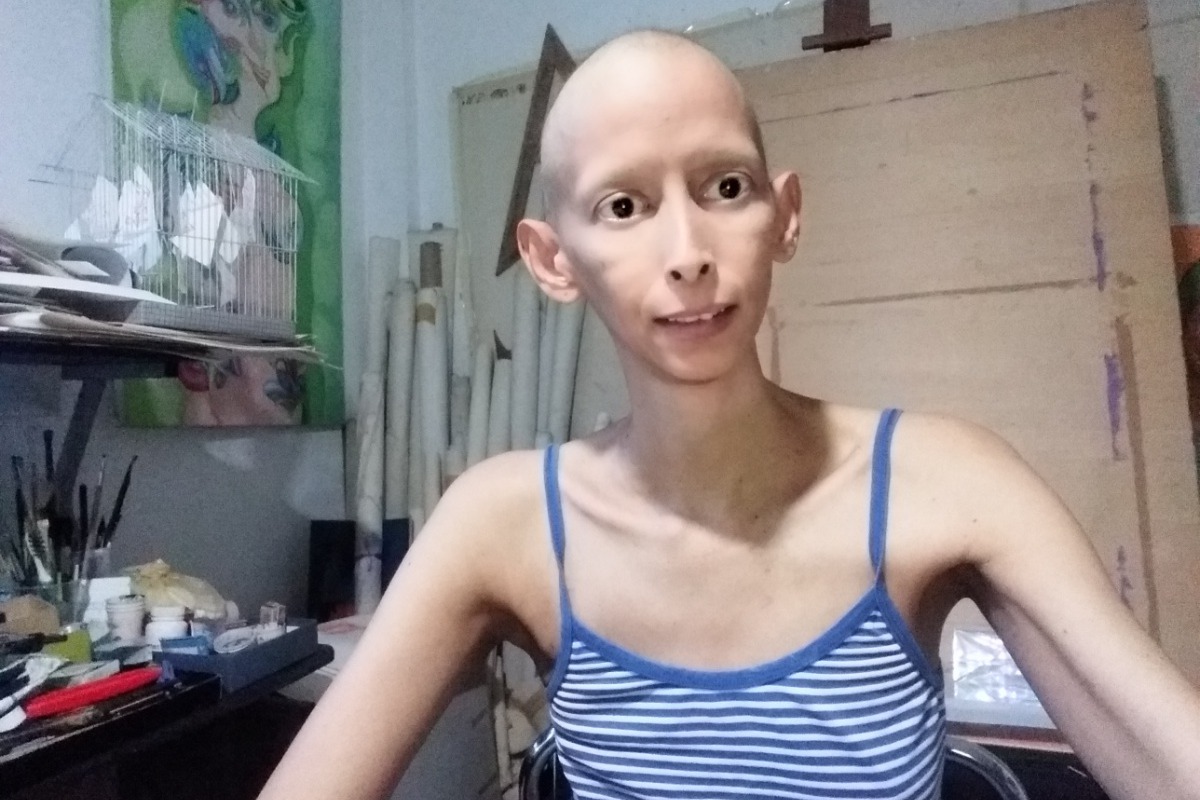 Fundraiser by Mirna Cellitti : Medical Expenses for Nereida Gonzalez Veraza