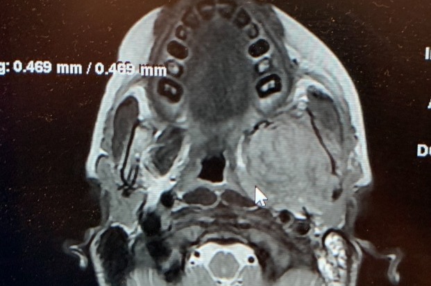 Fundraiser for Luke Fowles by Amy Darrington : Love for Luke