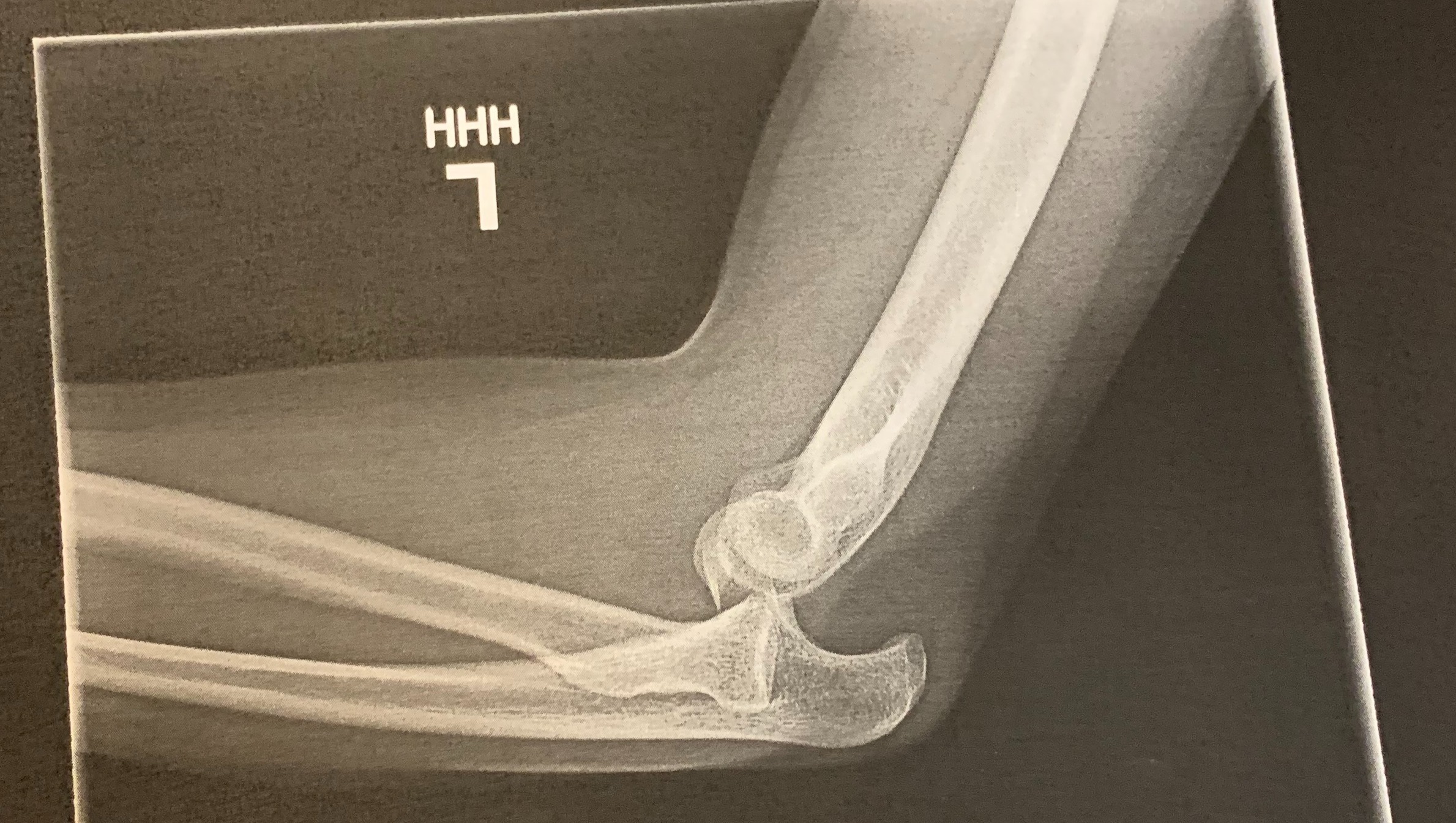 Fundraiser by Melody Marie Ebner : Help Melody Ebner pay her medical bills