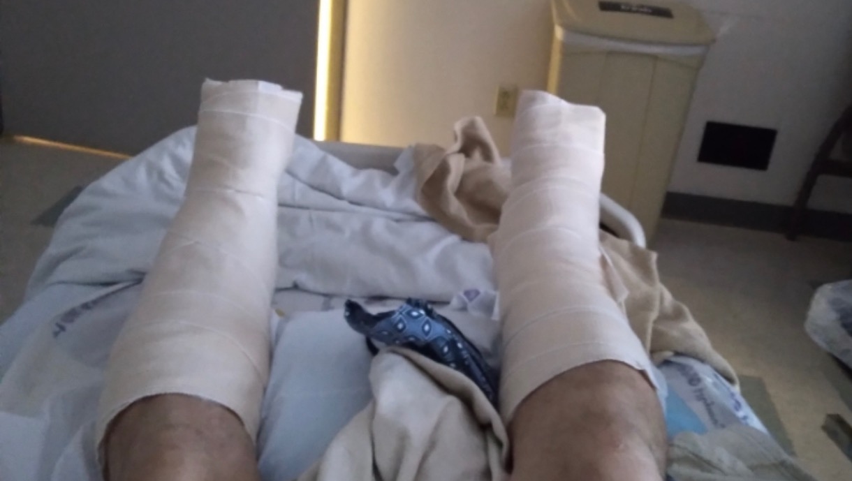 Fundraiser for Kevin Malstrom by Noorullah Azim : Help Kevin during ...