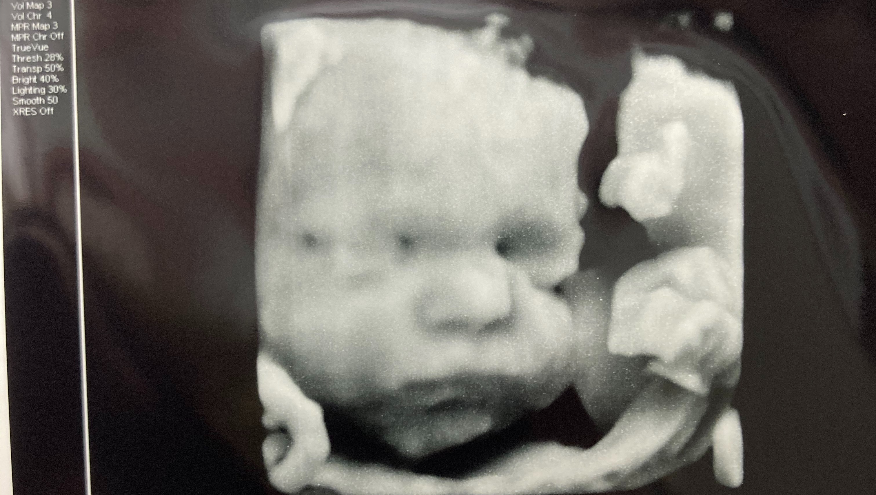 Fundraiser for Marshall Ray Hardman by Alexandra Kidd : Helping The ...