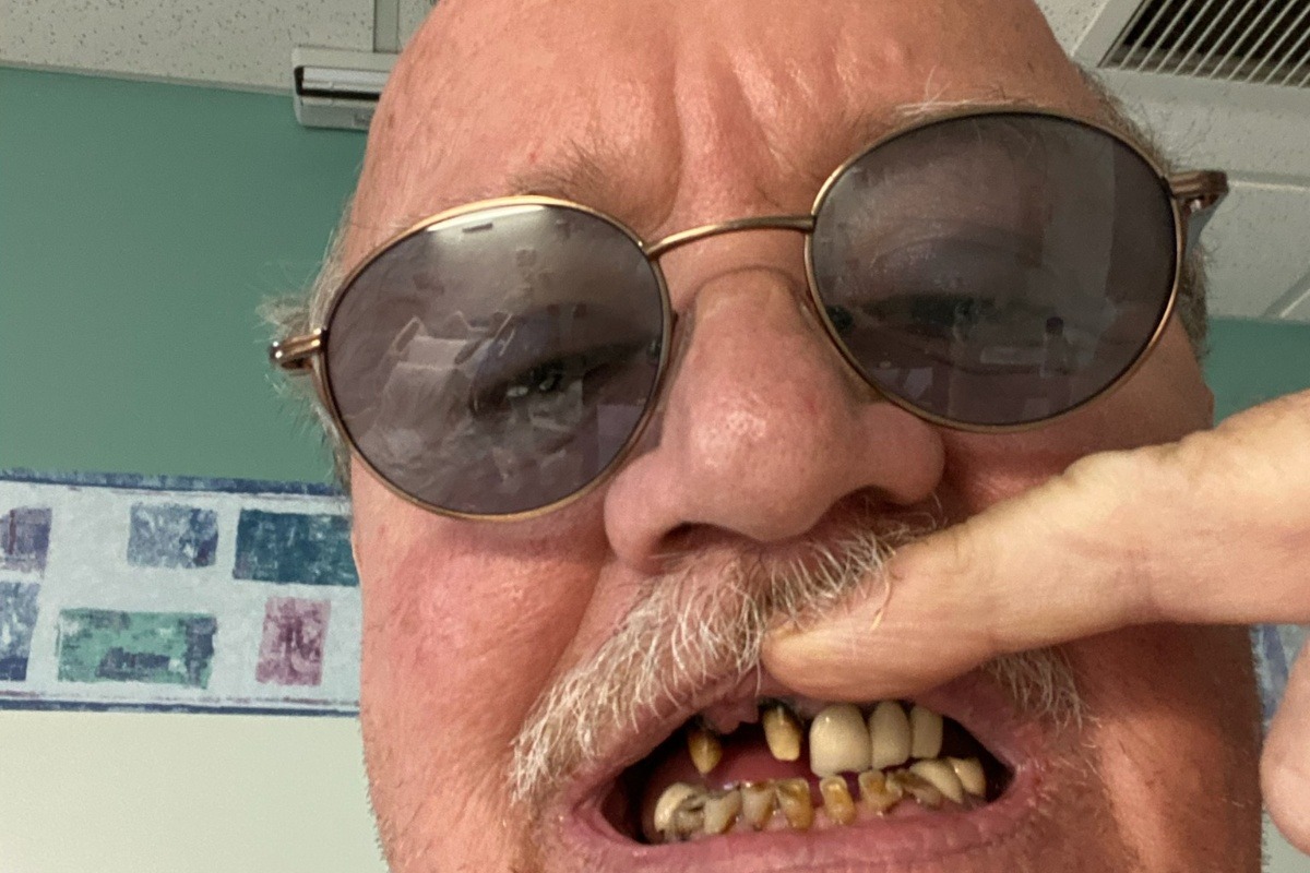 Fundraiser by Larry Park : Help Gary Dan Regain His Teeth