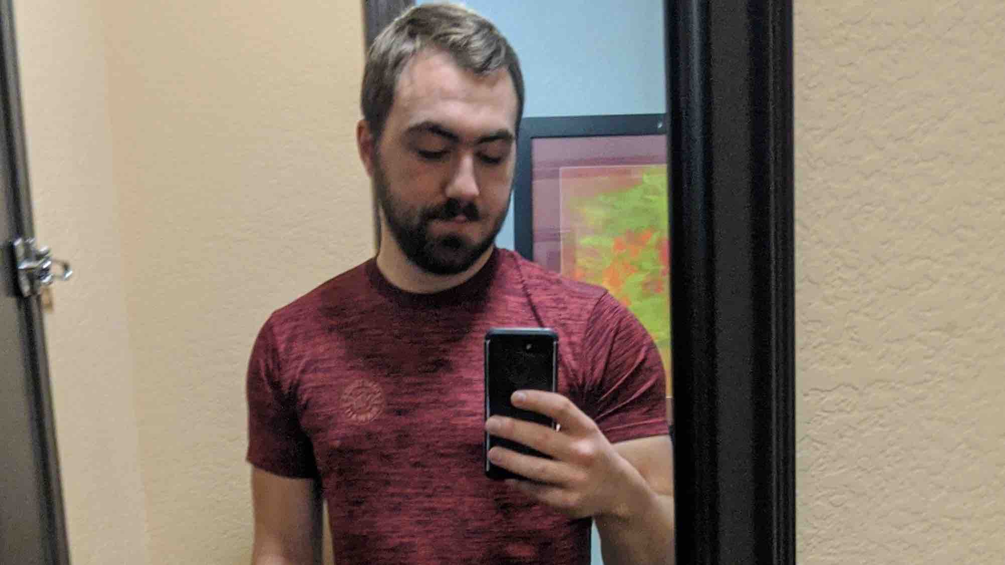 Fundraiser by JARED CLAY : Help me pay medical bills!