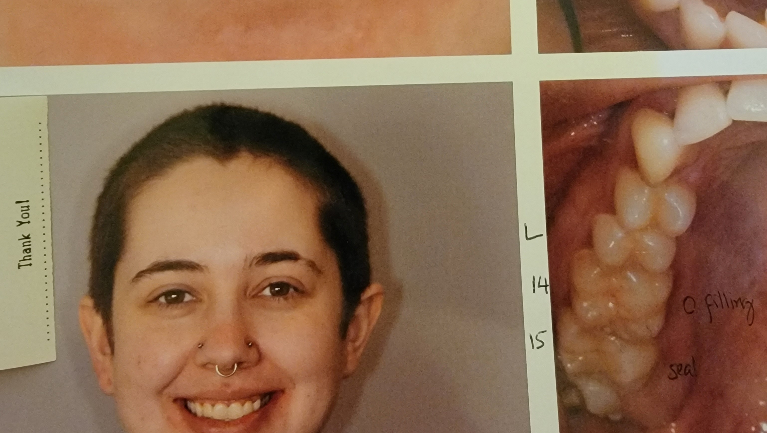 Fundraiser by James Matthews : Help James Have Less Teeth