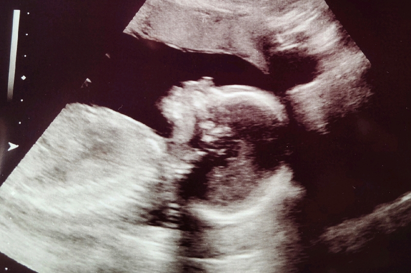 Fundraiser for Sylvia Gladden by Kyle A : Morgan and Sylvia