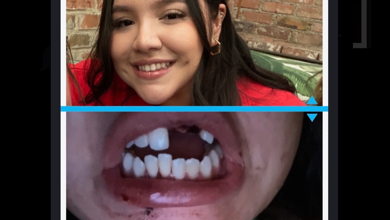 Fundraiser for Naomi Calderon by Ashley Delgado : Help Naomi smile again