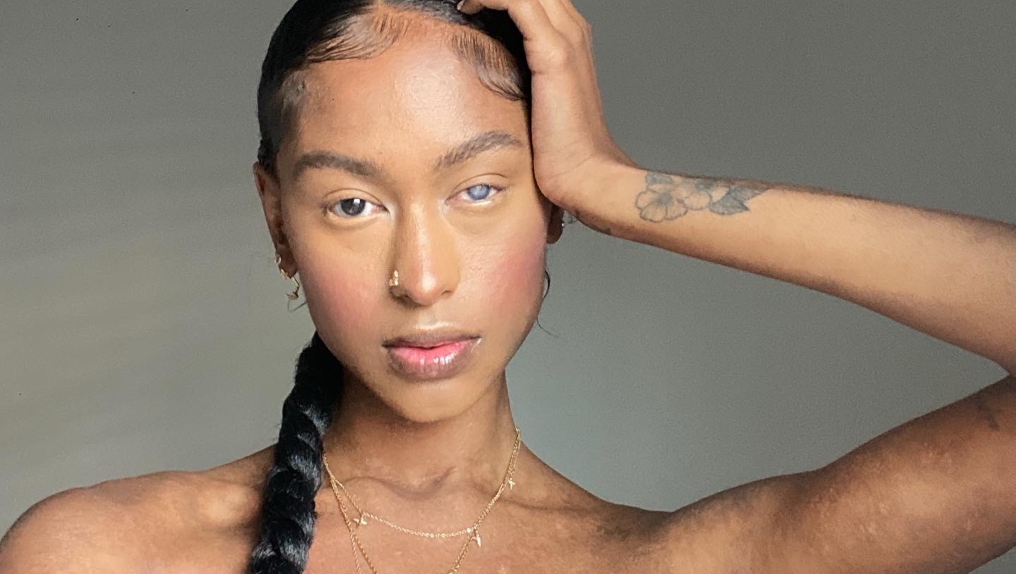 Fundraiser by Amber Rodriguez : Assist Amber’s SJS Recovery Journey