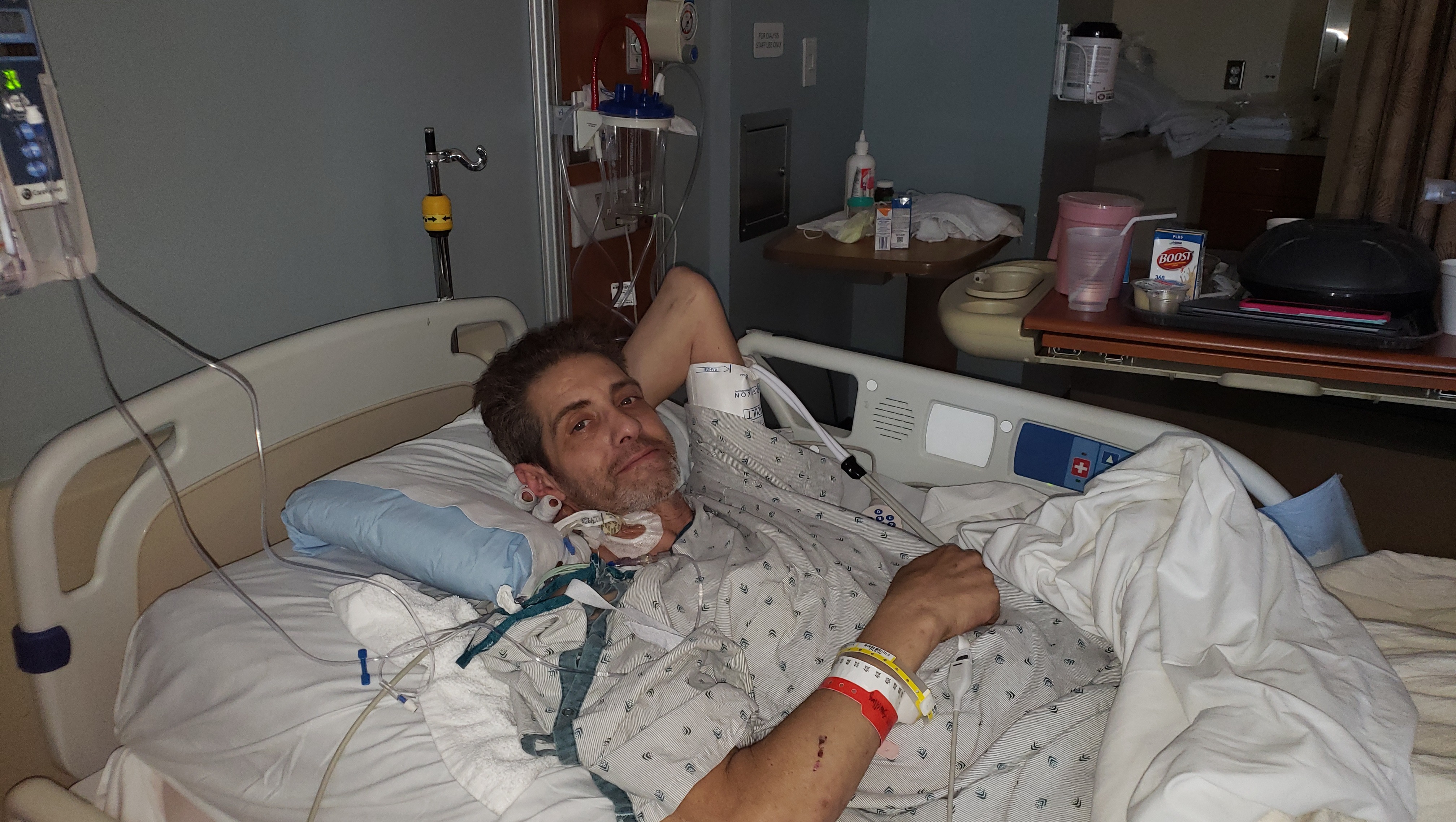 Fundraiser by Keith Siegman : Help an amputee rebuild his life