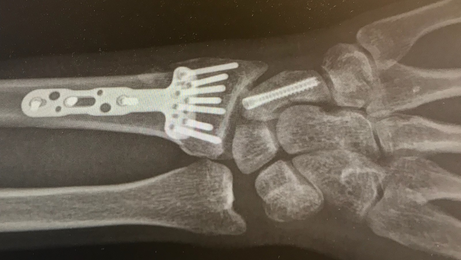 Fundraiser for Letanya DV Hayzlett by Jill Younce : Help Gage brush off ...