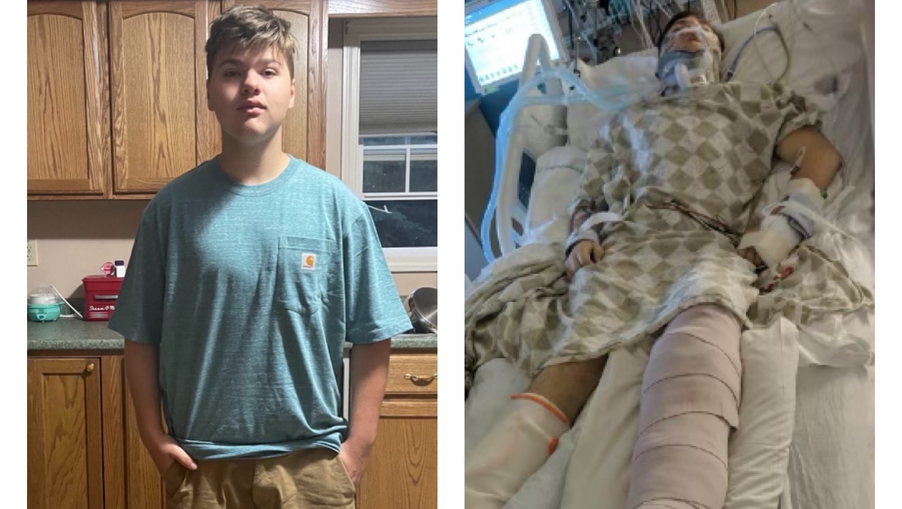 Fundraiser for Edwin Nickerson by Robin Wallace : Edwin’s Recovery