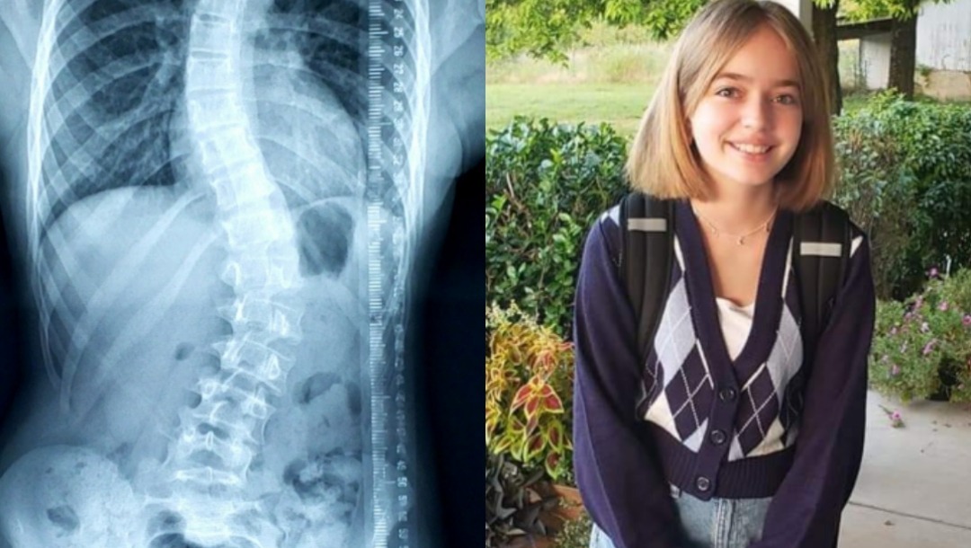 Fundraiser for Sharon Duff by Suzanne Jernigan : Spinal Surgery For ...