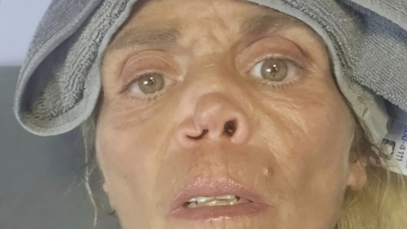 Fundraiser by Michelle Ovadia : Battling Cancer and Wegeners