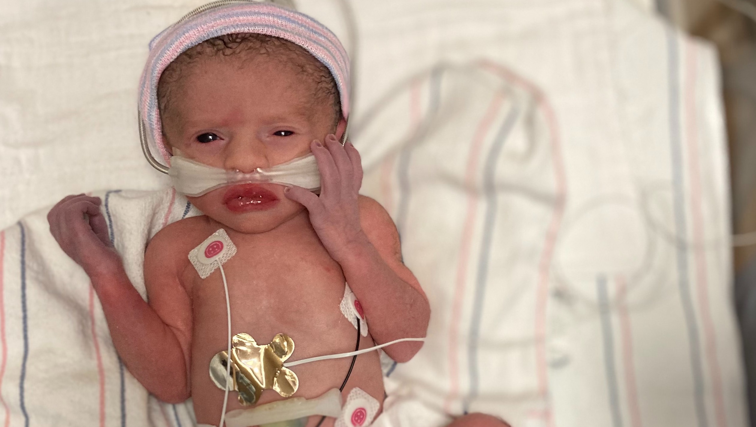 Fundraiser by Alethea Schmidt : Help Baby Alaska, Alethea and Egan