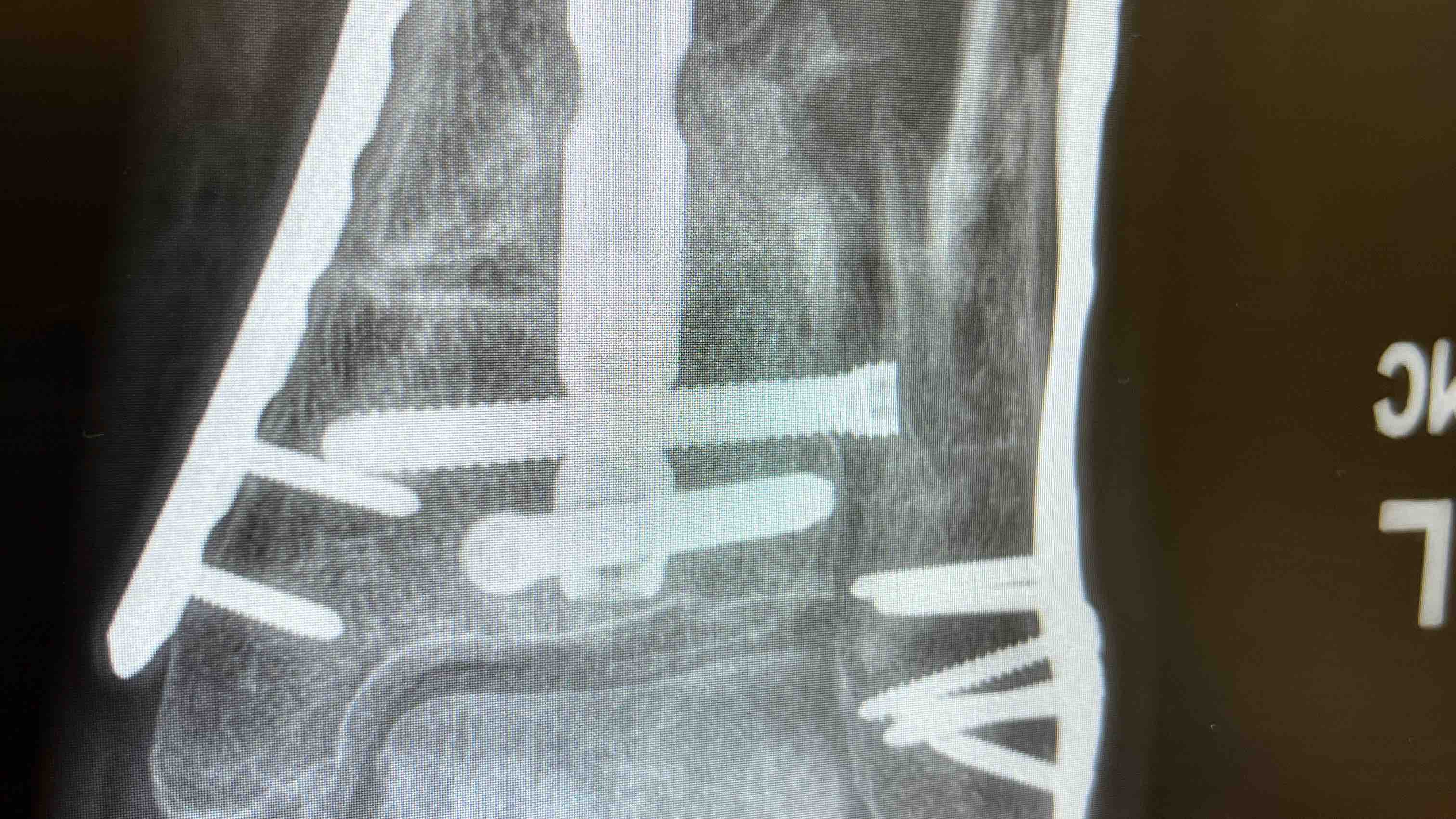 Fundraiser for Rusty Landry by Frannie Landry : Medical and Travel Expenses