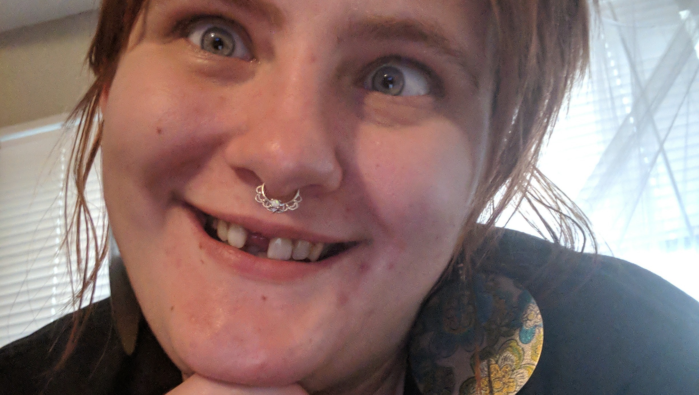 Fundraiser by Jayde Hartman : Jaydes root canal and implant