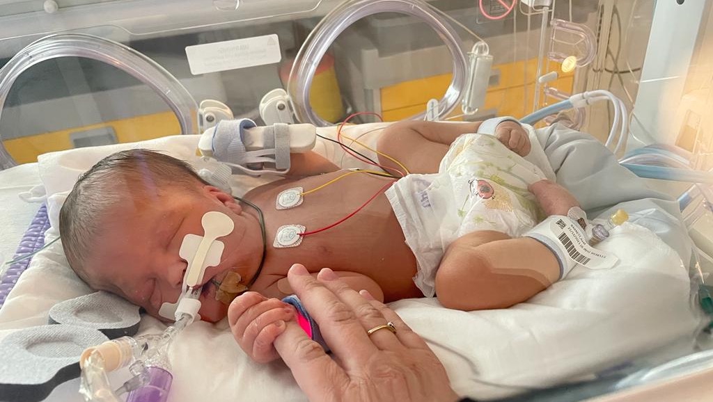 Fundraiser by Fiona Morrell : Help Support Baby Axel in his Fight for a ...