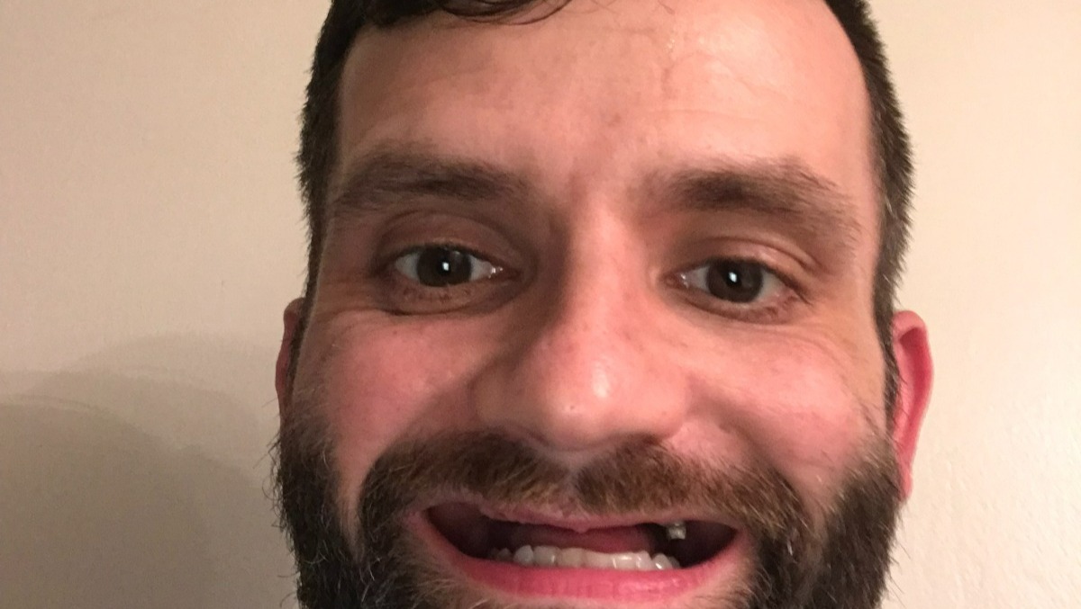 Fundraiser by Jack Mabe : Help Jack smile again!