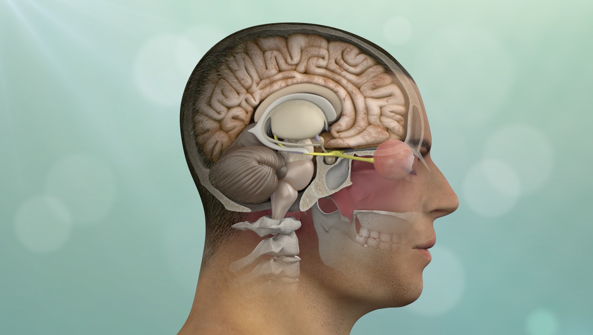 Fundraiser by J T : Help my aunt remove a brain tumour