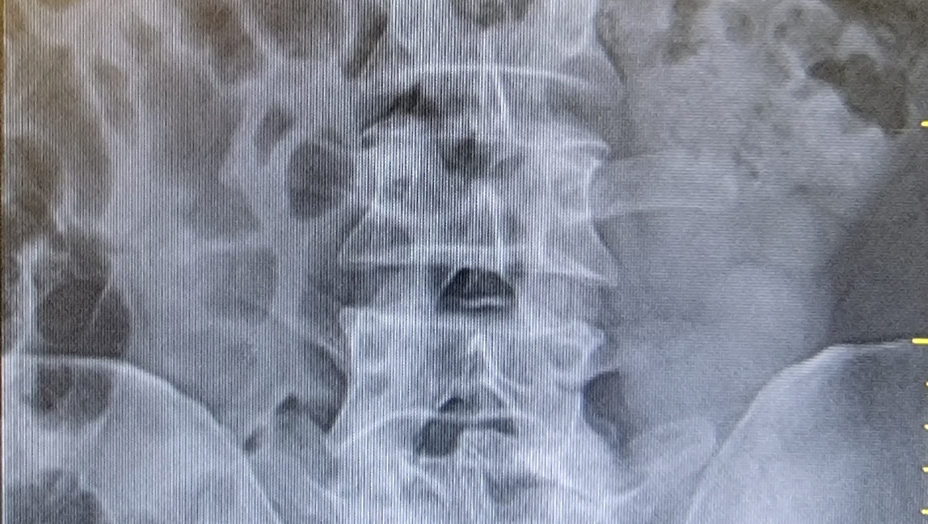 Fundraiser by Jason Genge-Robinson : Father and husband in need of surgery