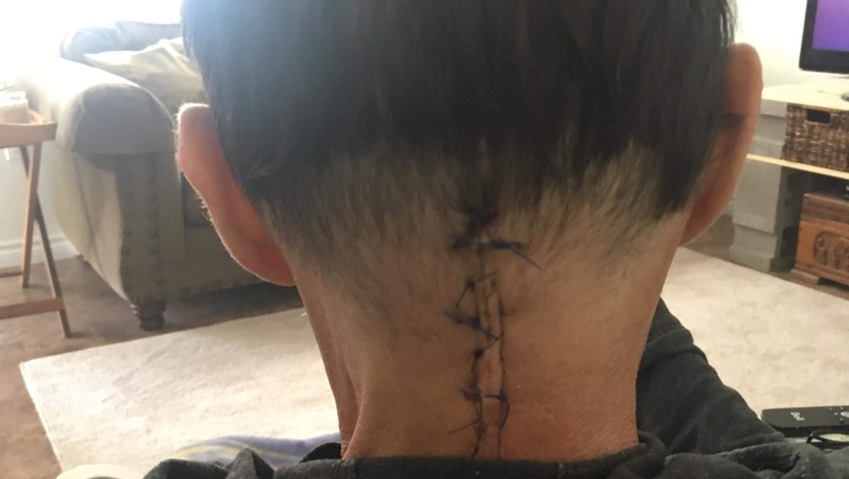 Fundraiser for Cory Kucey by Colleen MacRae : Please help for Darin for ...