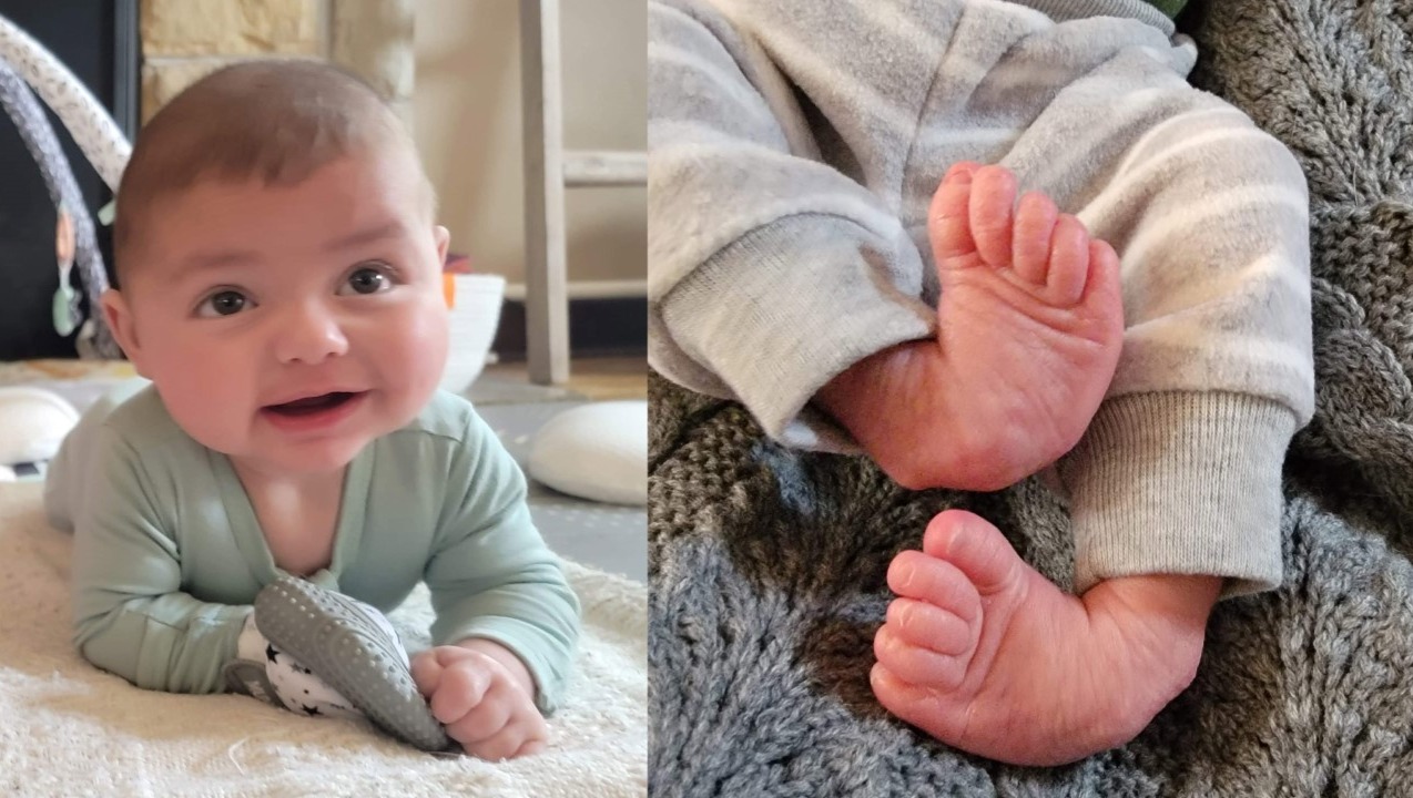 Fundraiser for Lacey Bell by Natalie Rugg : Timmy Jr's Clubfoot Journey