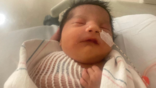 Fundraiser by Lauren Ziyaaein : Baby Girl Born Without Ears & in Need ...