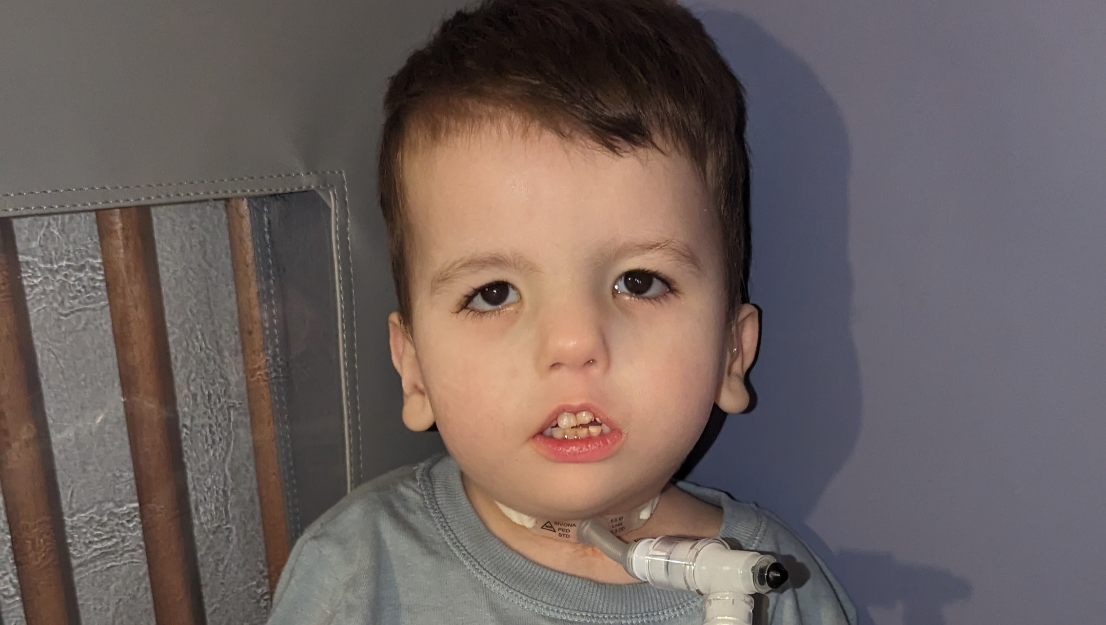 Fundraiser by Amber Nuttall : Help Teddy get his independence