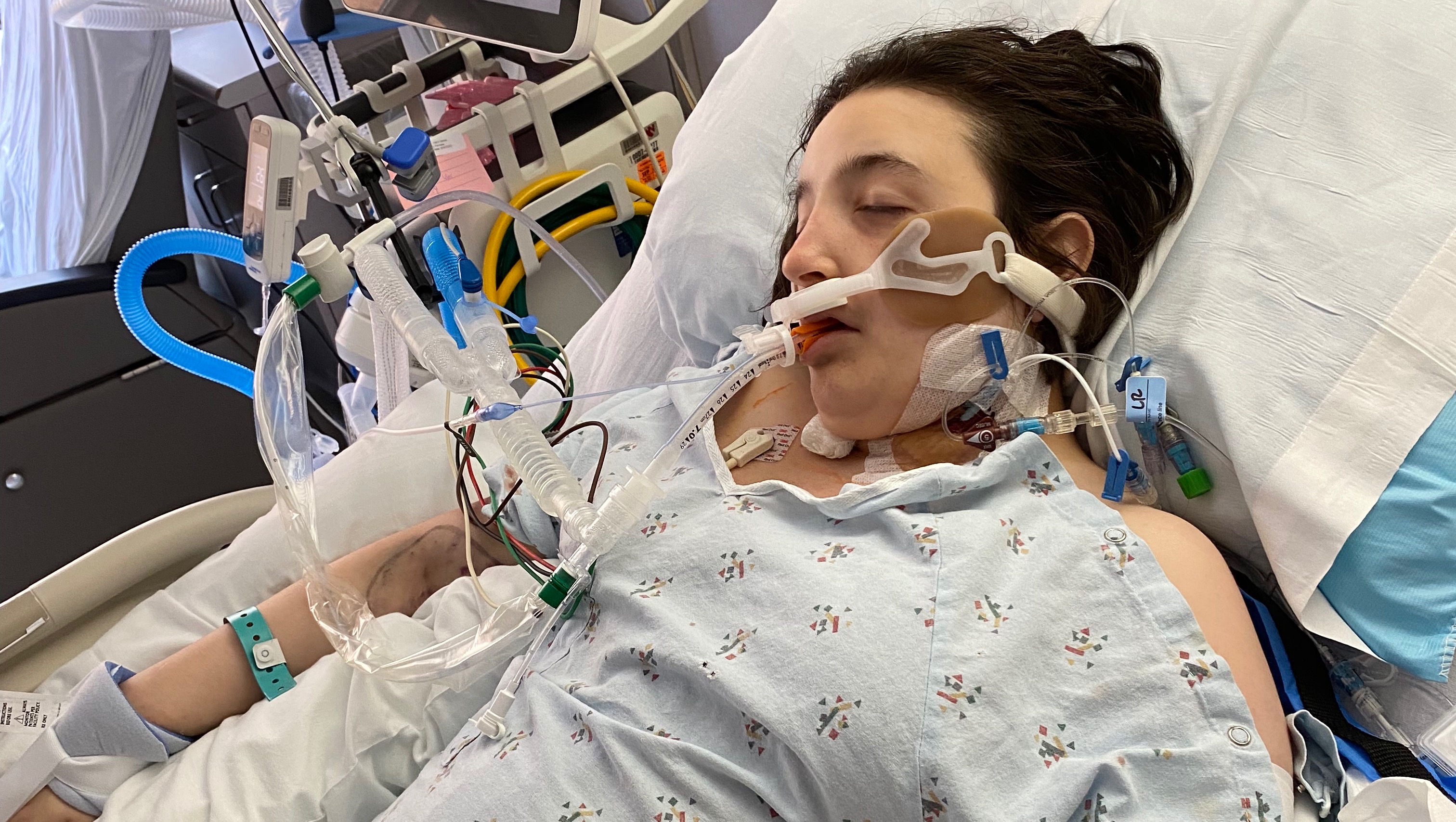 Fundraiser for Lora Caves by Macey Caves : Retts Go Meredith