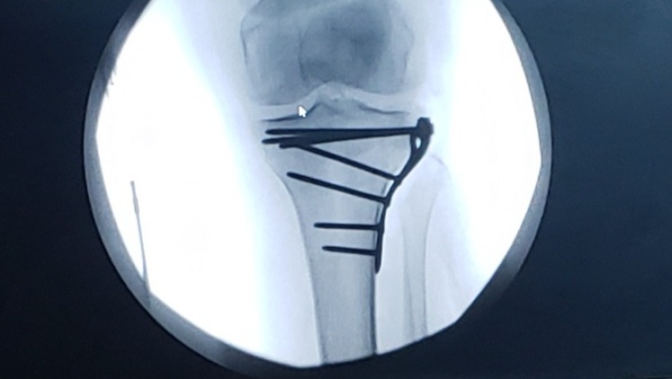 Fundraiser by Debra Wilds : Dawn Dennison until her recovery is complete.