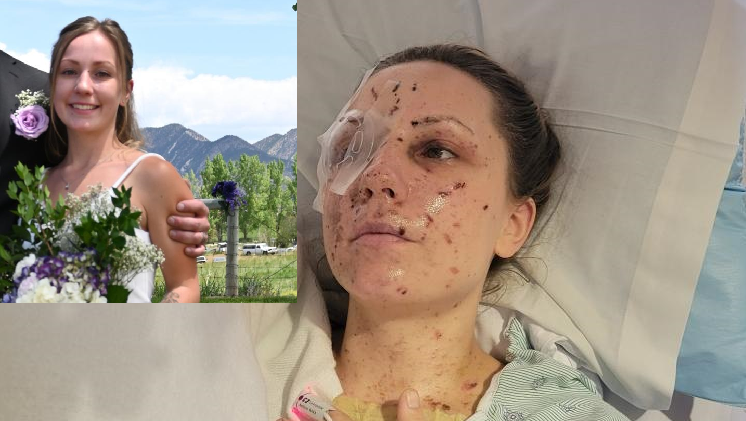 Fundraiser for Stephaine Garza by Vicki Clark-Schneider : Horrible ...