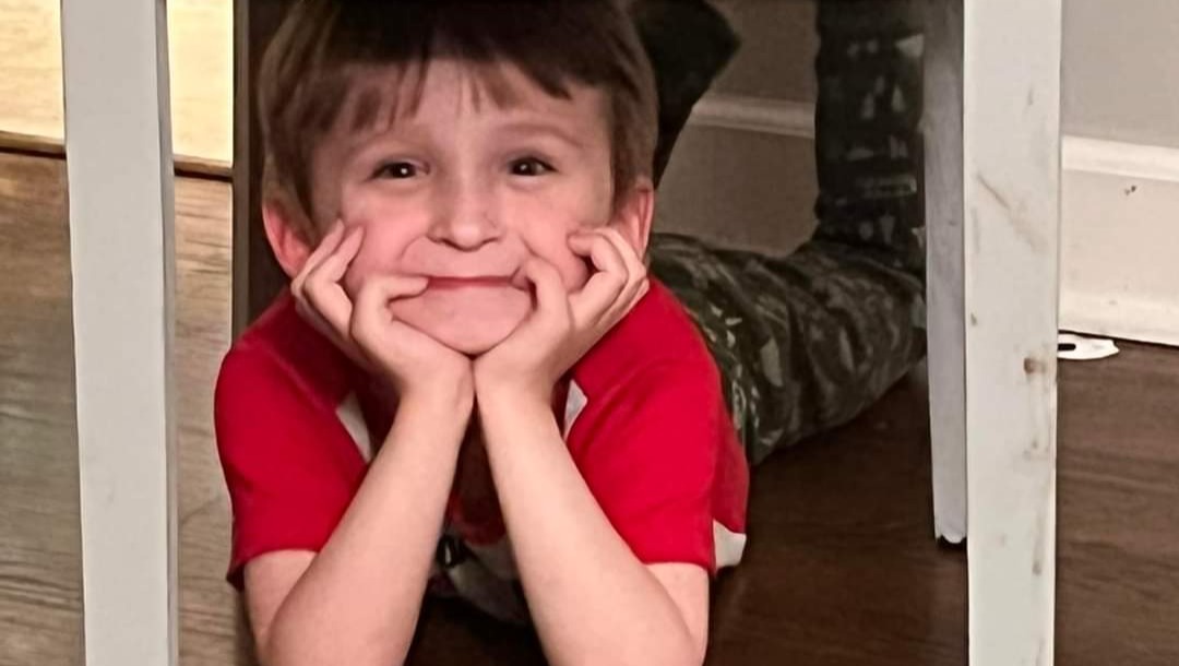 Fundraiser by Amanda Connell : Help us get a prosthetic, Please