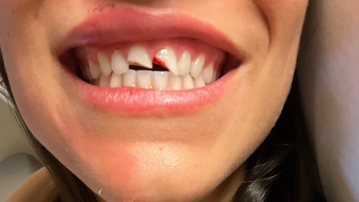Fundraiser for Alyssa Waters by Mike Ash : Help Alyssa fix her teeth