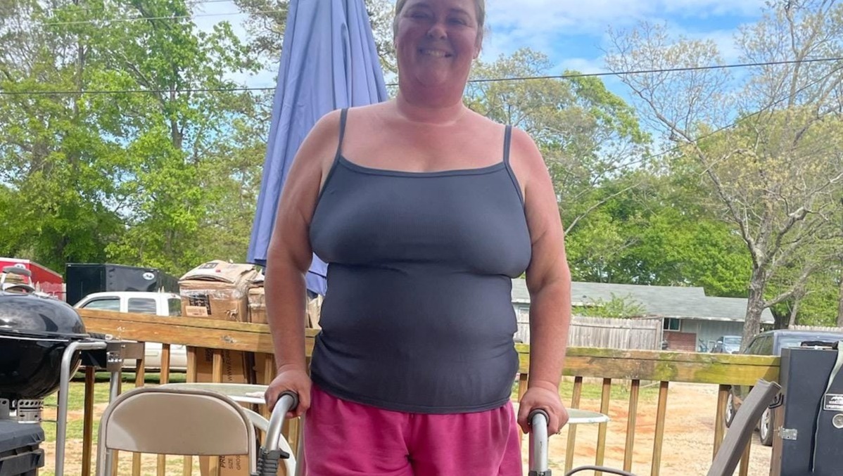 Fundraiser By Misty Price Fitted Prosthetic Leg 
