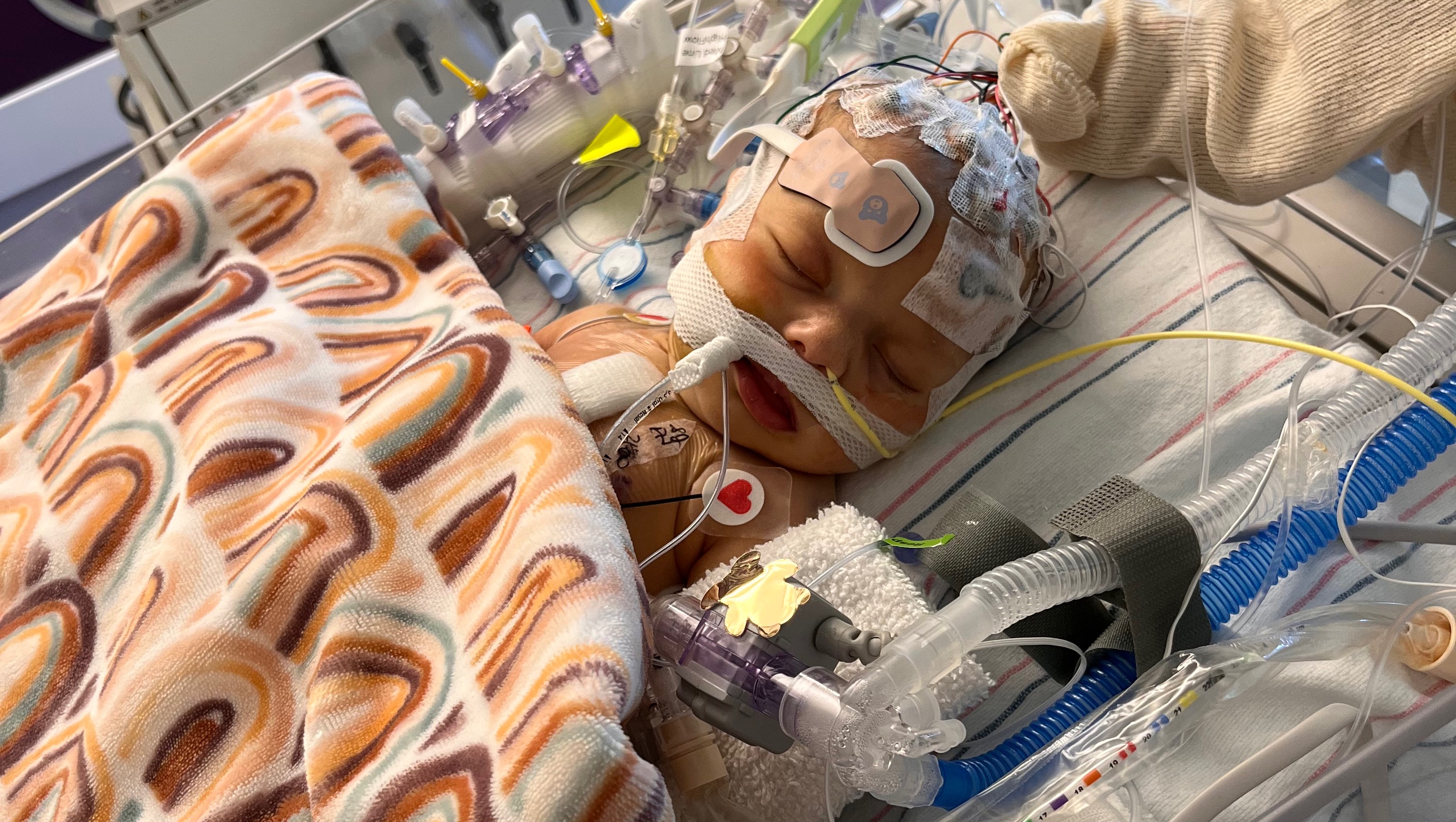 Fundraiser for Richard Taylor by Shawnna Christman : Maeve - Our Little ...