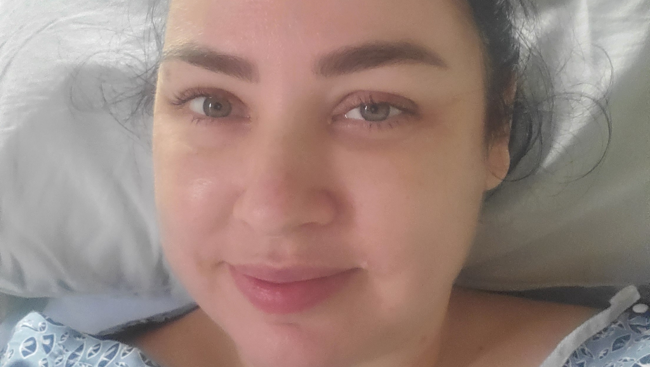 Fundraiser for Brittany ORourke by Chris O'Rourke : Brittany's Injuries ...