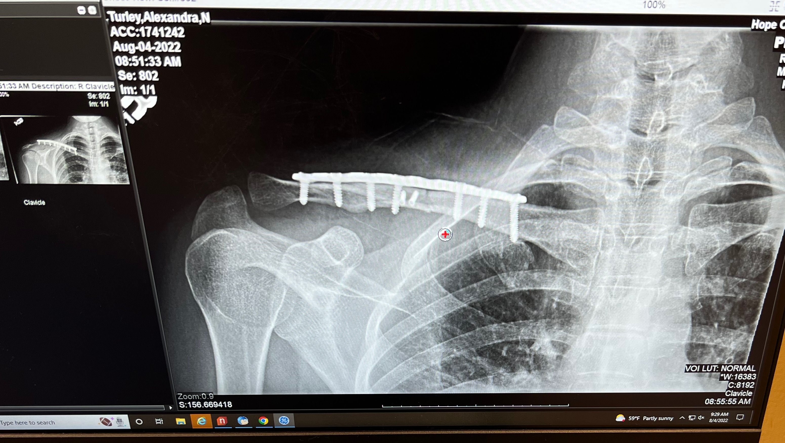 Fundraiser by Alex Turley : A Tale of Recovery ️‍