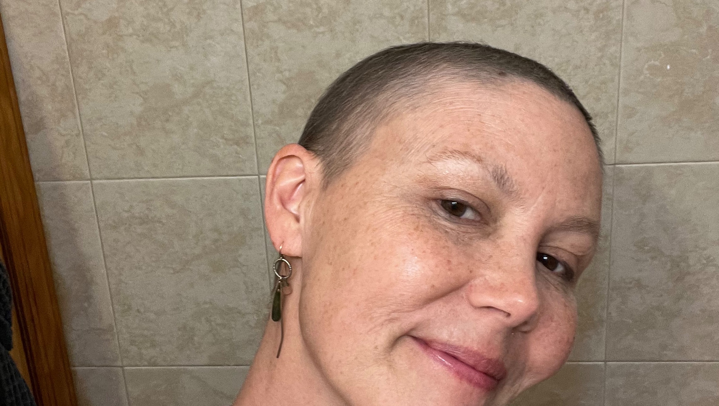Fundraiser by Stacey Carlson : Donate to help Stacey beat Breast Cancer