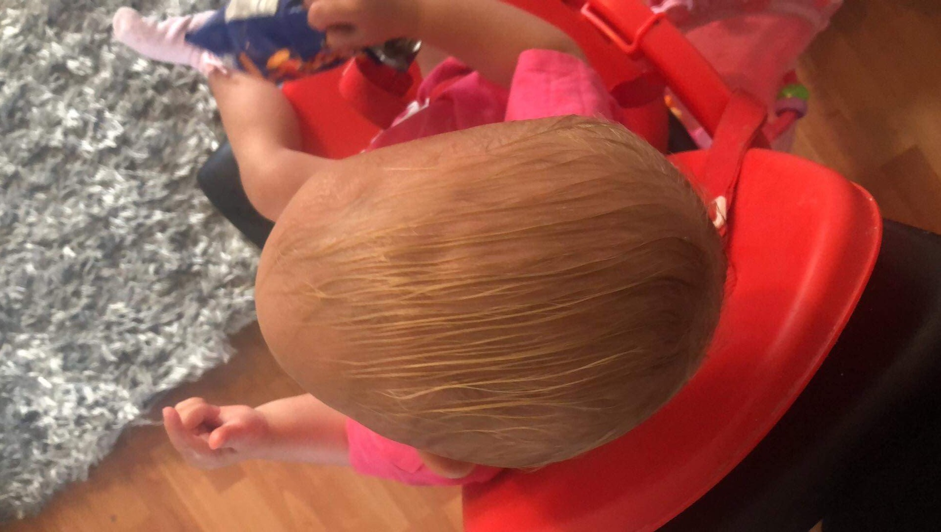 Fundraiser for Marc Curt by Leanne Mead : Jorja's Plagiocephaly Helmet ...