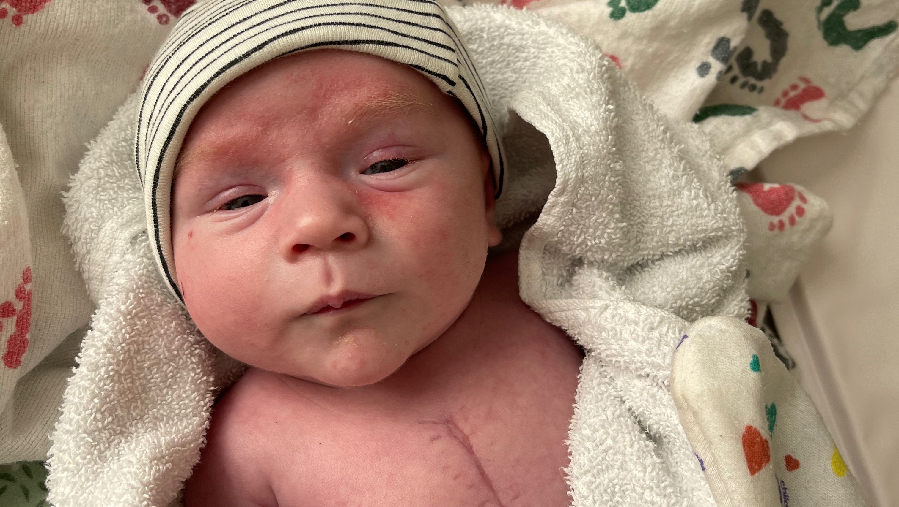 Fundraiser for Edward Buffington by Jessie Buffington : Baby Ed ...