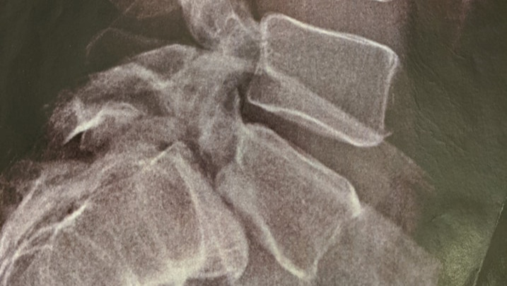 Fundraiser by Anthony Rosario Calfo : Dire need for legal and medical ...