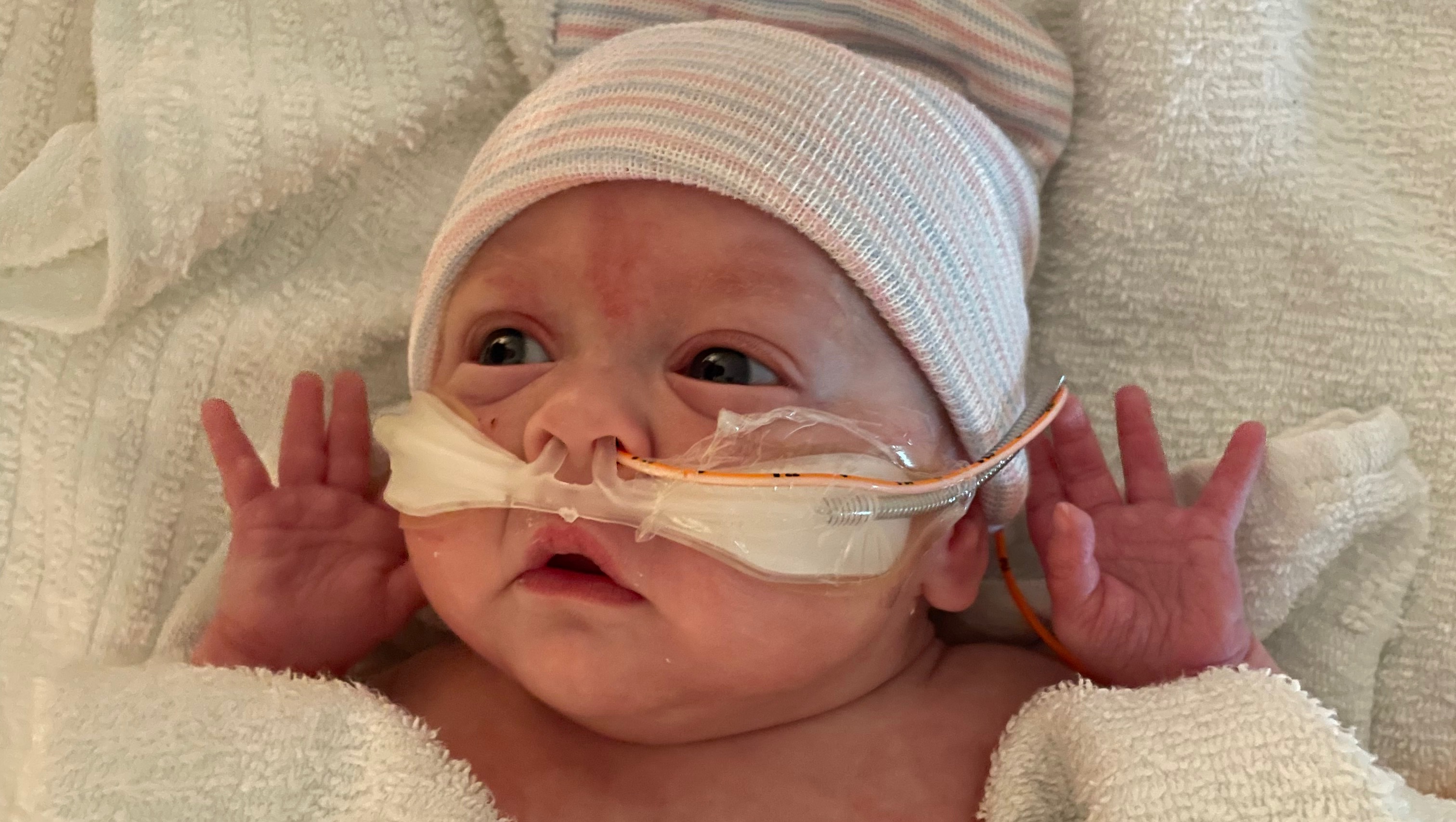 Fundraiser for Bailey Ash by Robyn Robinson : Help for Baby Josephine ...