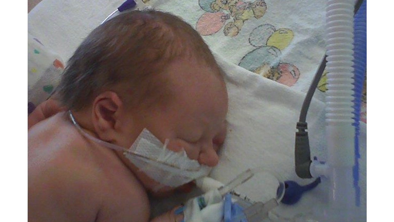 Fundraiser for Allison Burgess by Julie Burgess : Blake Edward Ray ...