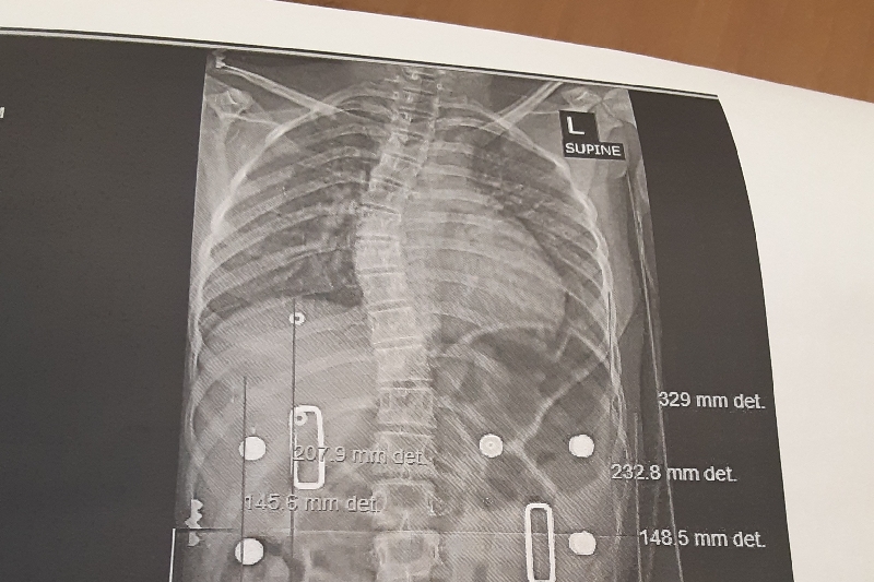 Fundraiser by Charlie Fales : Help for Recovery